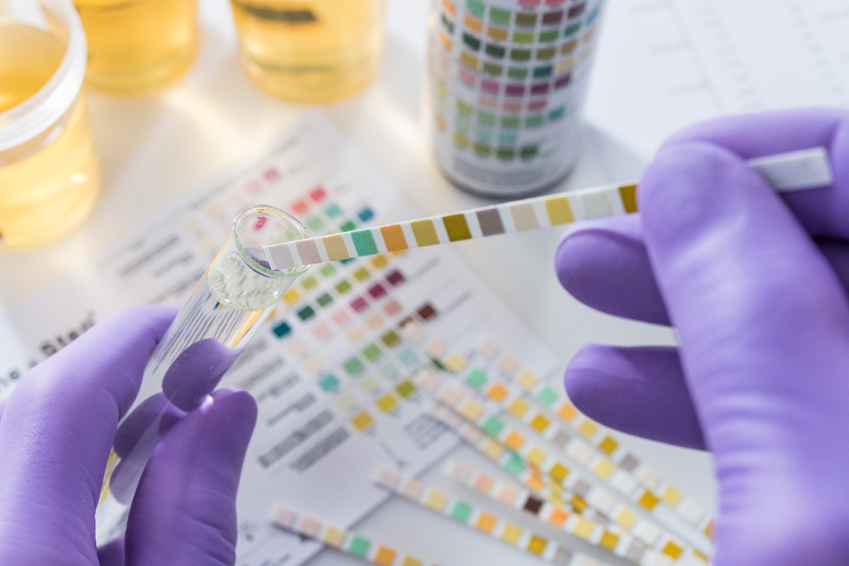 Occupational Drug Testing | Data Facts